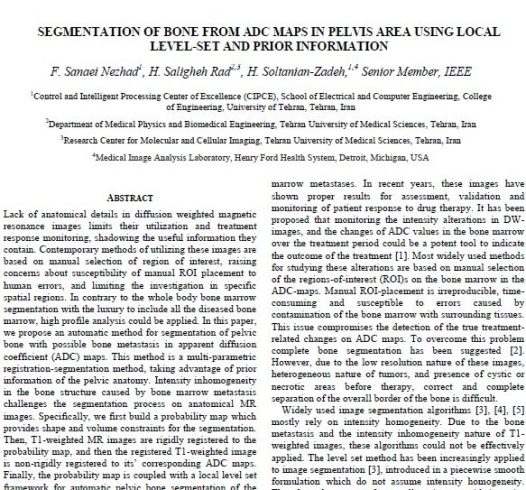 Segmentation of bone from ADC maps in pelvis area using local level-set ...